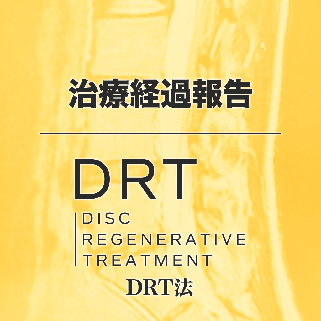 The Impact of Post-Disc Regenerative Treatment Rehabilitation on ...